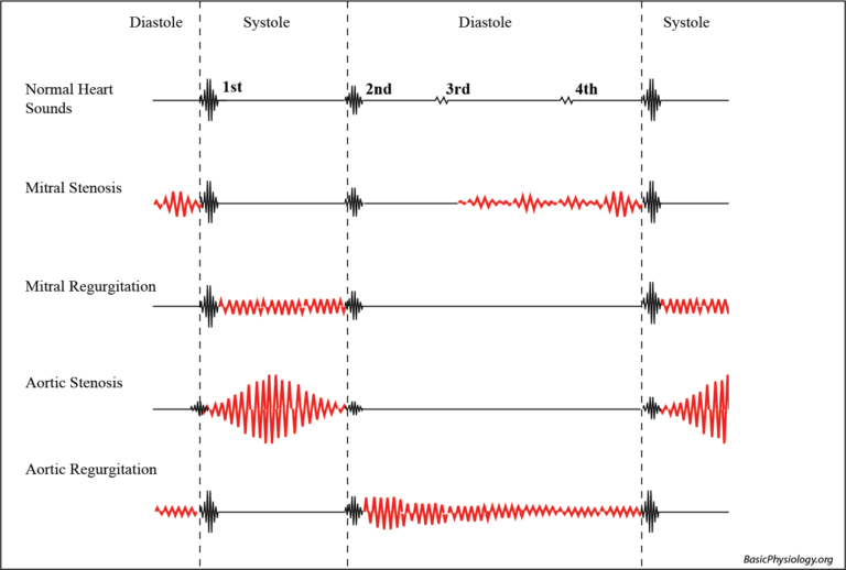 B.4.5. Cardiac Sounds and Murmurs – BasicPhysiology.org