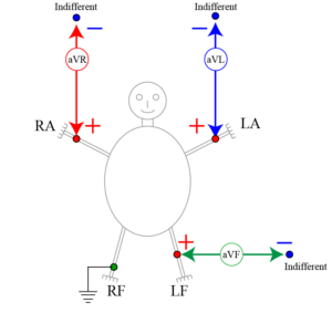 B.3.5. The 12-leads ECG – BasicPhysiology.org
