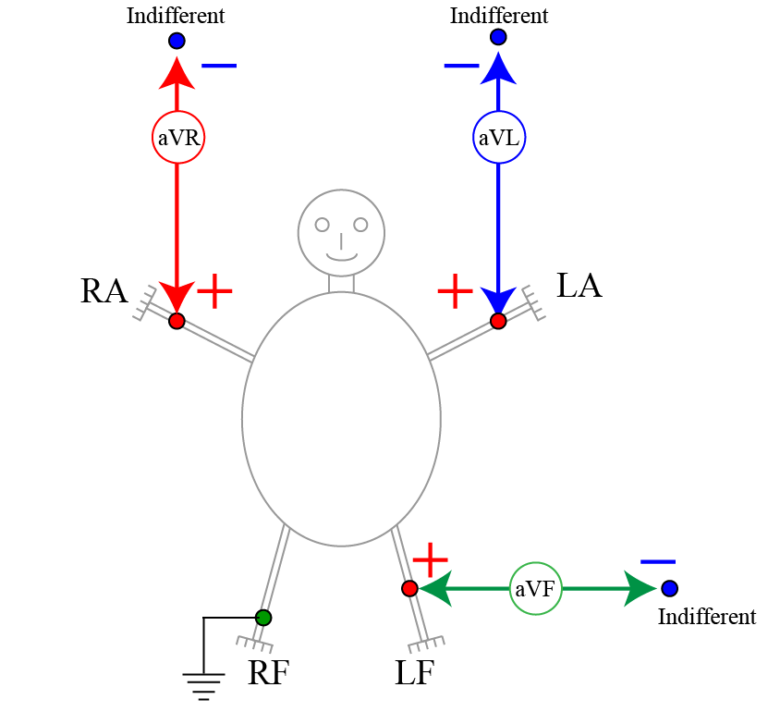 B.3.5. The 12-leads ECG – BasicPhysiology.org
